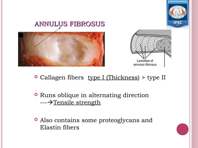 Intradiscal procedures current evidence | PPT