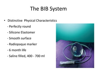 Intragastric balloons 2014 | PPT