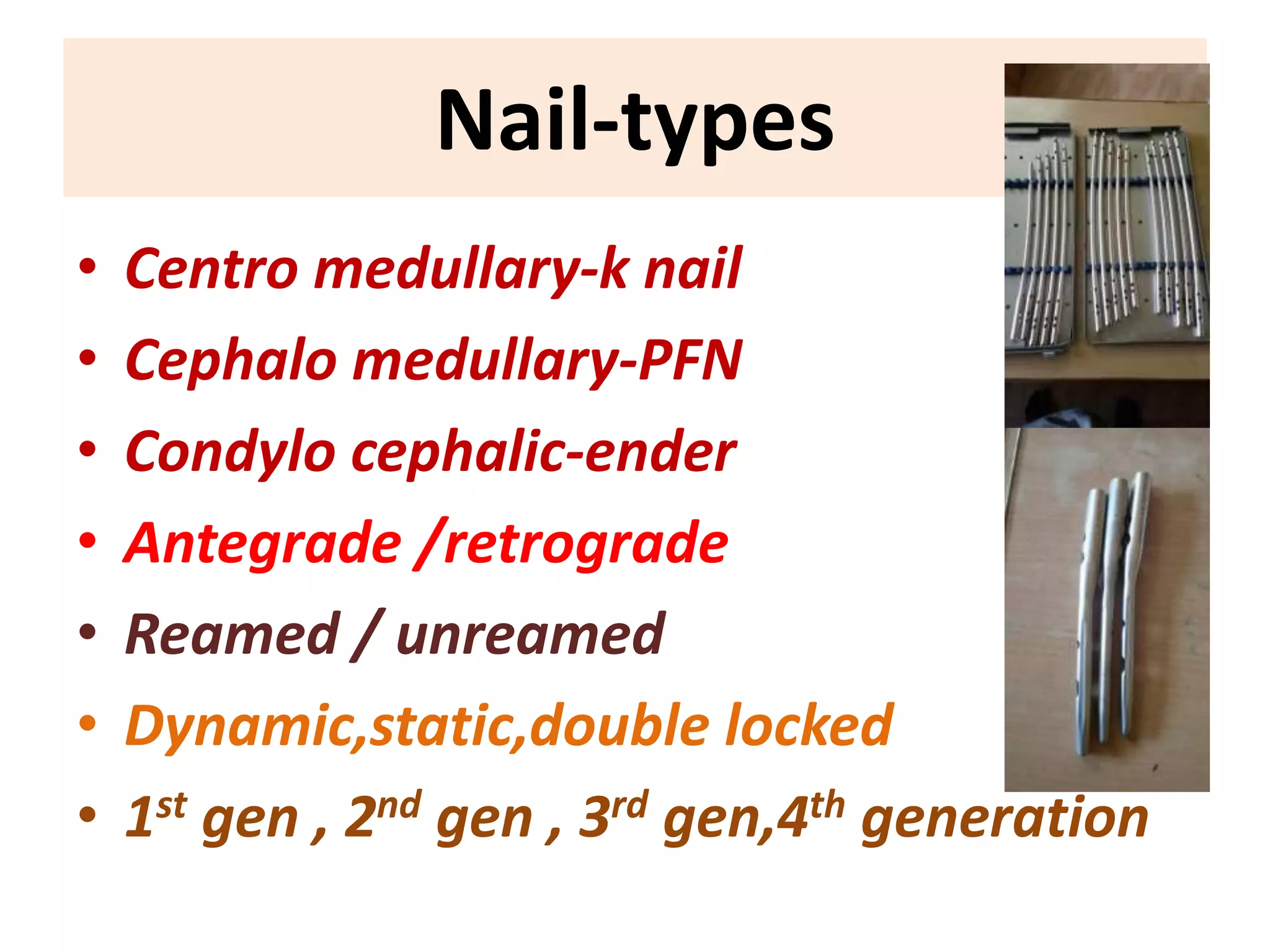 Intramedullary nailing of fractures.dr mohamed ashraf.HOD.govt TD ...