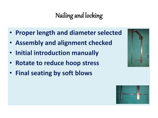 Intramedullary nailing of fractures.dr mohamed ashraf.HOD.govt TD ...
