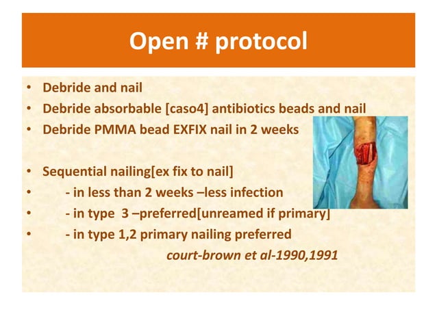 Intramedullary nailing of fractures.dr mohamed ashraf.HOD.govt TD ...