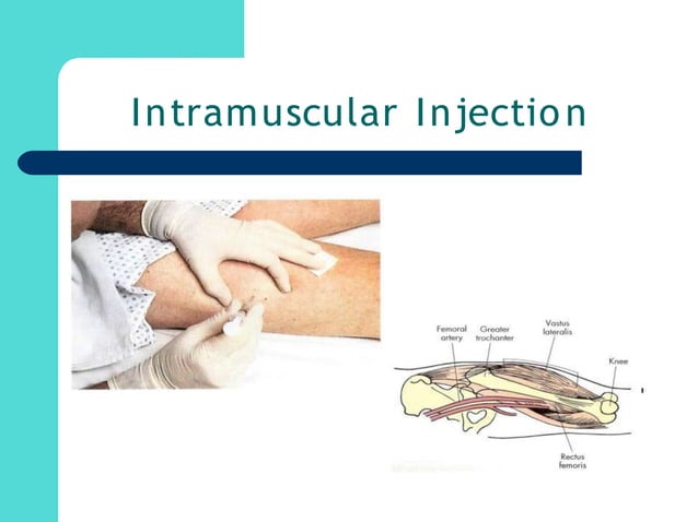 INTRAMUSCULAR ADMINISTRATION | PPTX