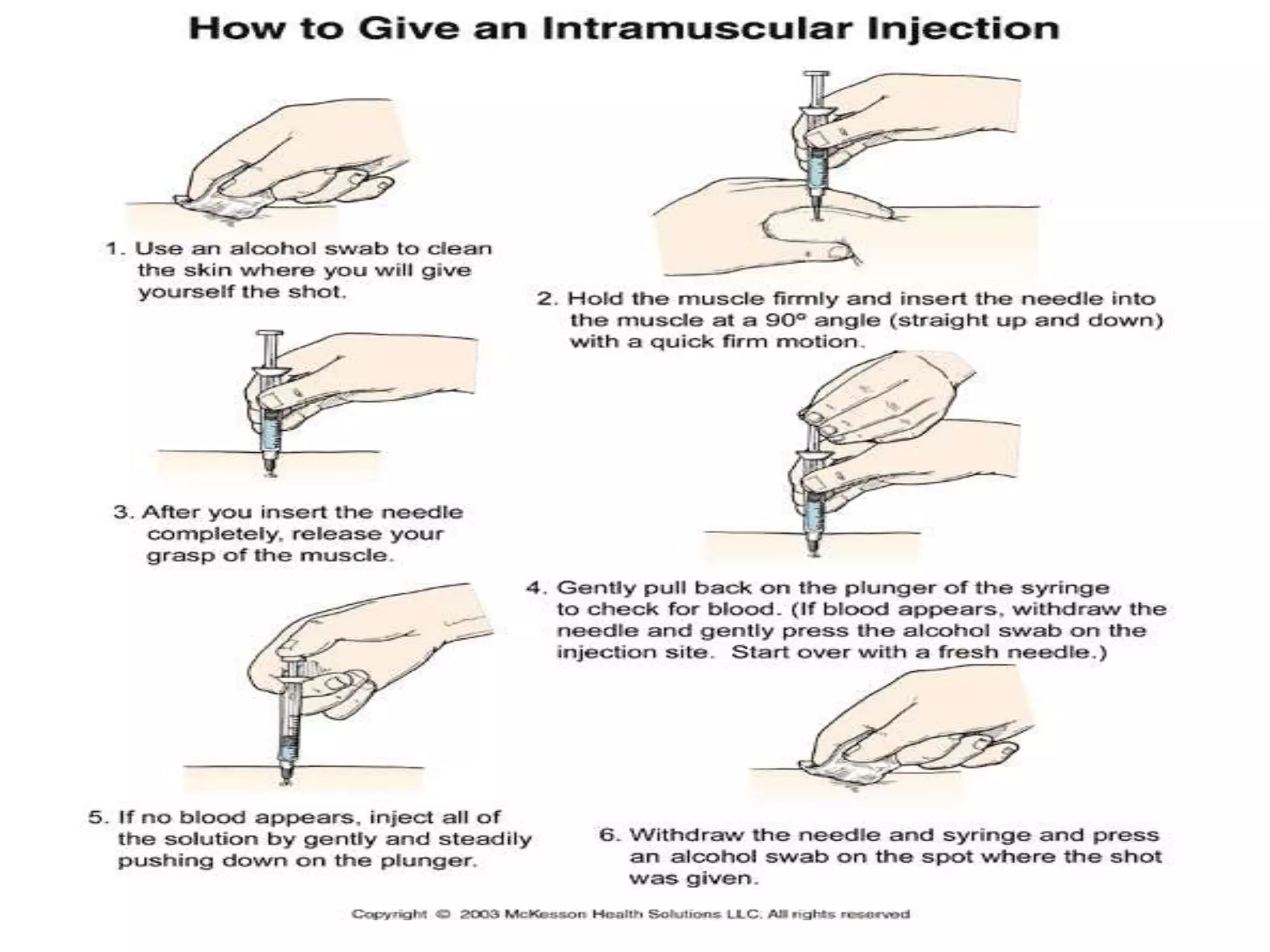 INTRAMUSCULAR INJECTION.pptx