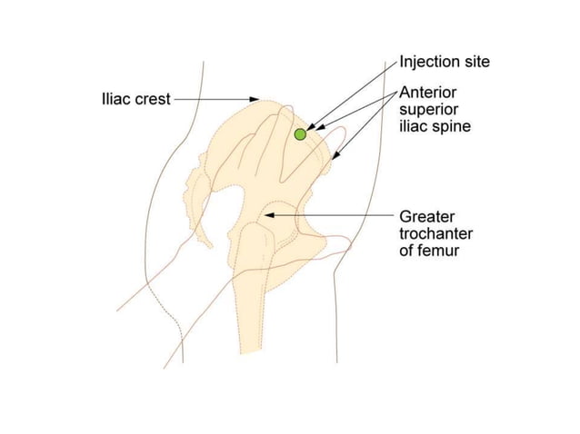INTRAMUSCULAR INJECTION.pptx | Physical Therapy | Wellness