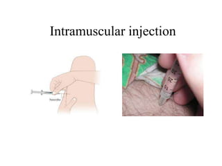 INTRAMUSCULAR INJECTION.pptx
