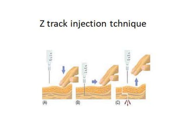 INTRAMUSCULAR INJECTION.pptx | Physical Therapy | Wellness