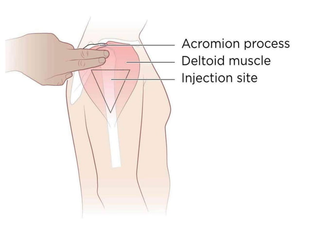 INTRAMUSCULAR INJECTION.pptx | Physical Therapy | Wellness