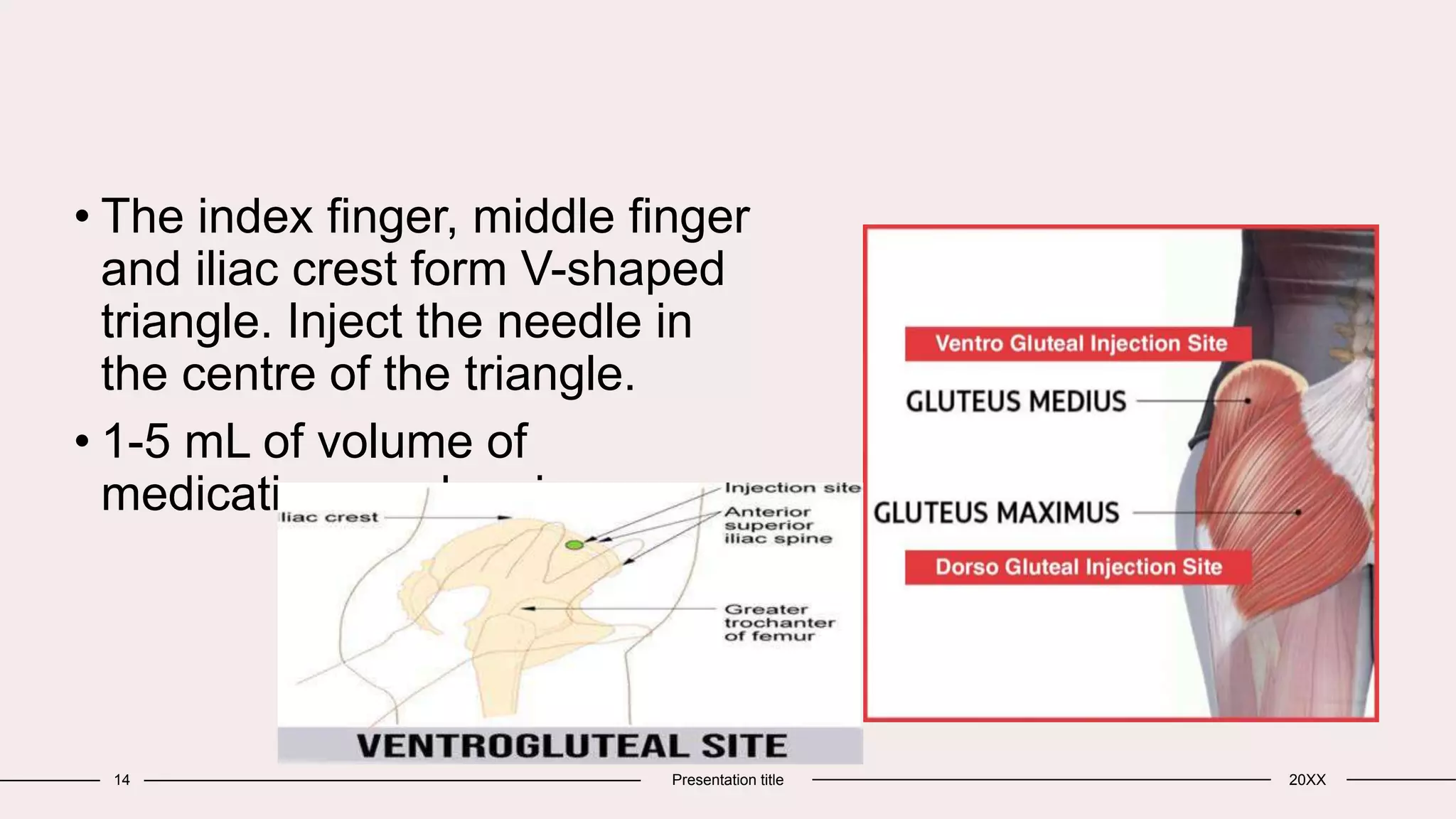 INTRAMUSCULAR INJECTION.pptx | Death, Injury, or Military Conflict ...