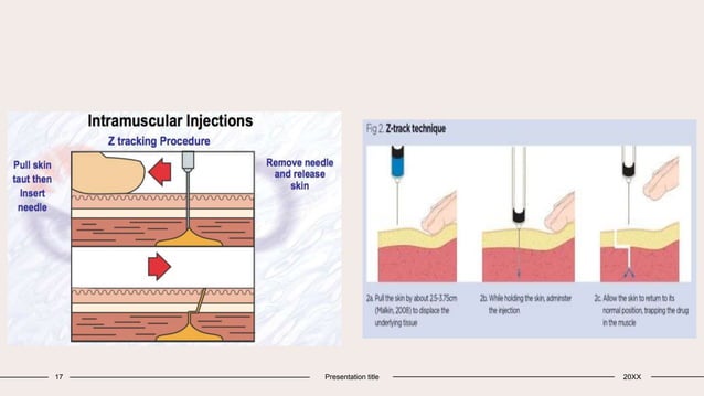 INTRAMUSCULAR INJECTION.pptx | Death, Injury, or Military Conflict ...