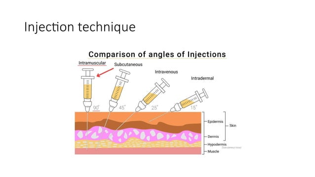 DRUG ADMINISTRATION, INTRAMUSCULAR INJECTION | PPTX