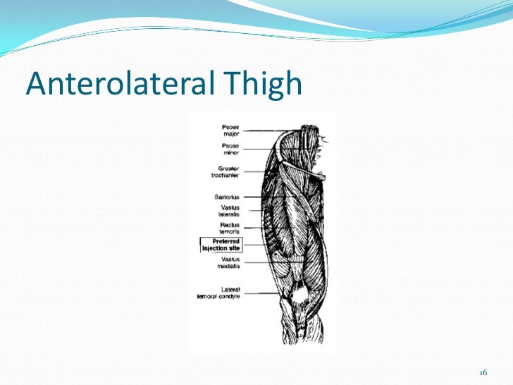Intramuscular injection ppp