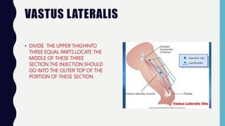 Intramuscular new | PPTX