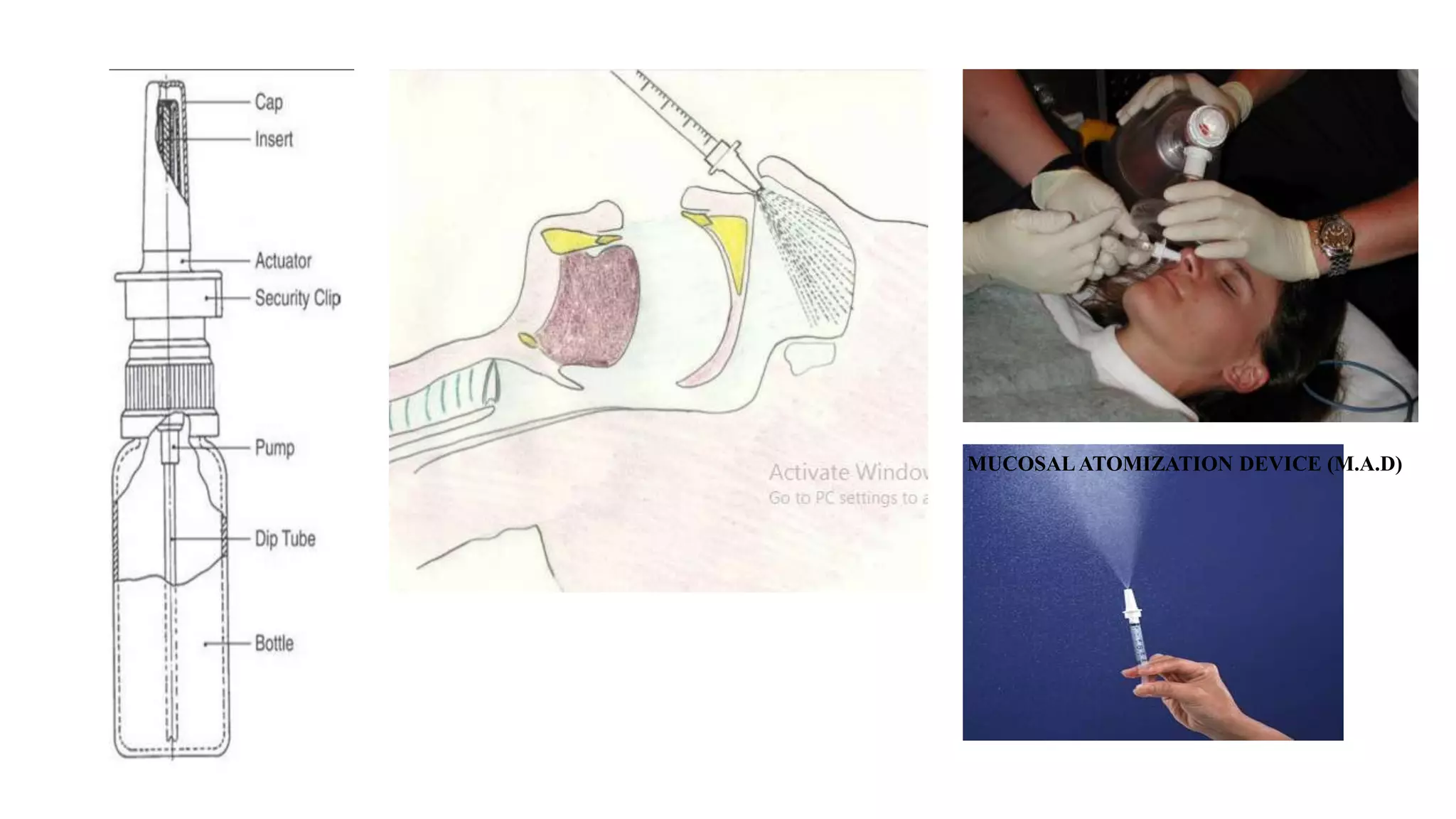 Intranasal route of drug administration | PPTX