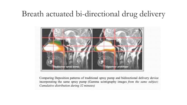 Intranasal route of drug administration | PPTX