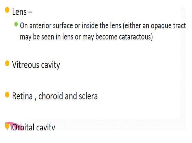Intraocular foreign bodies | PPTX