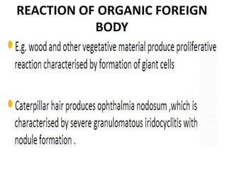 Intraocular foreign bodies | PPTX