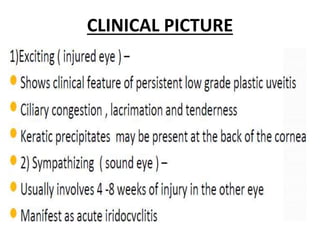 Intraocular foreign bodies | PPTX