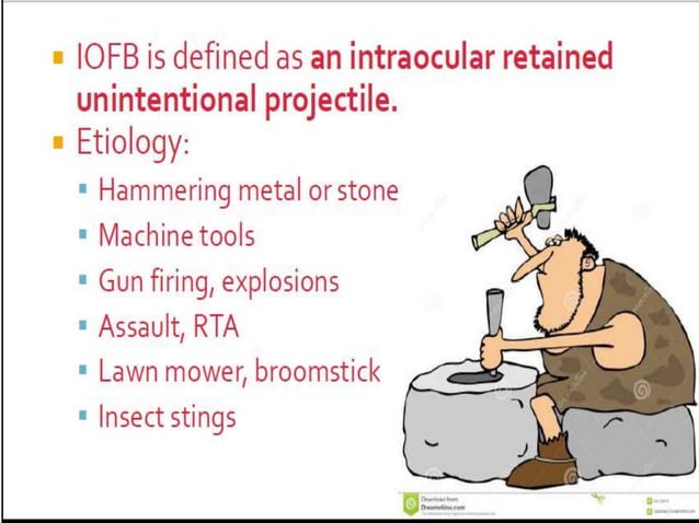Intraocular foreign bodies | PPTX