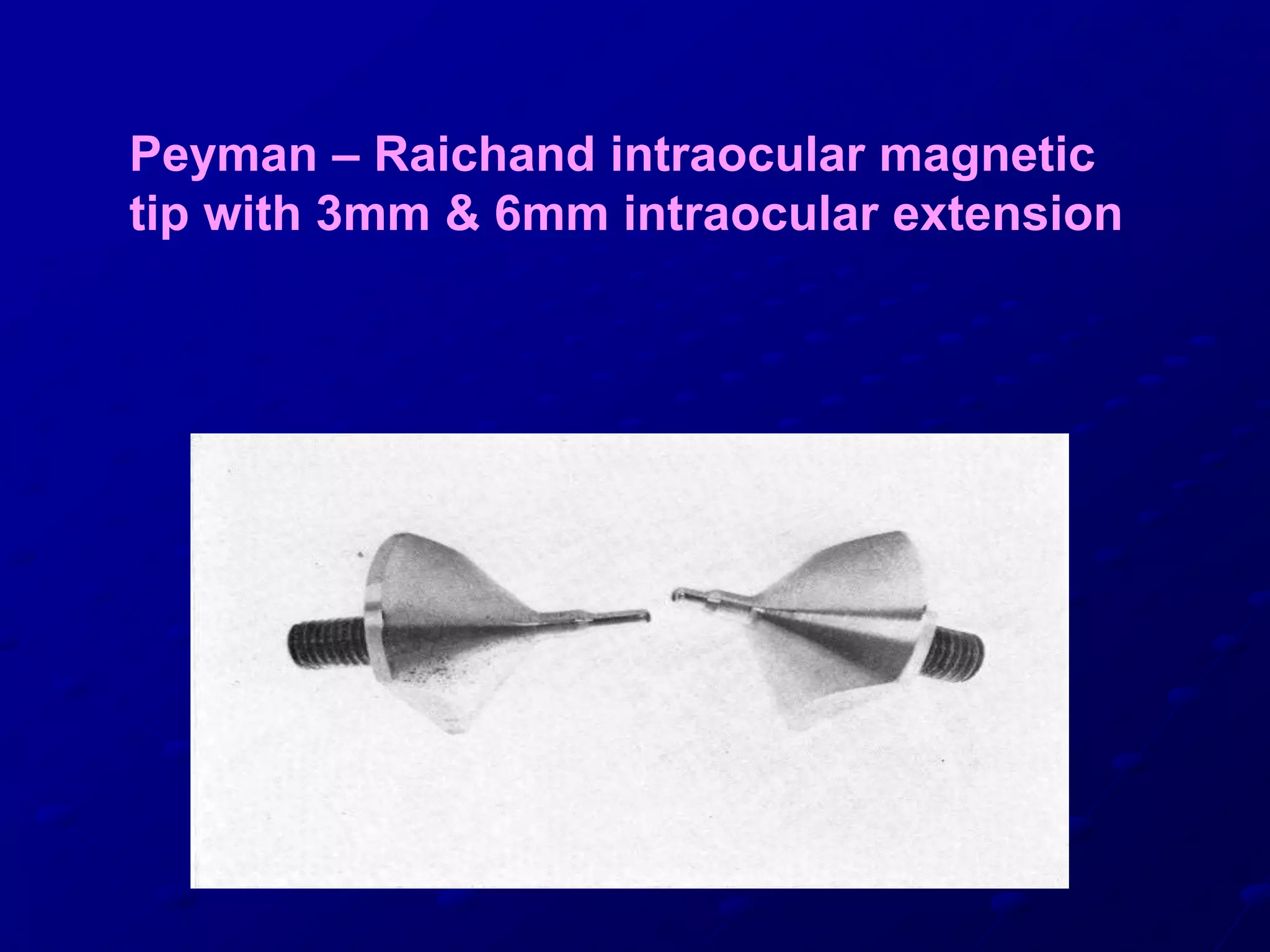 Intraocular foreign bodies - AJAY DUDANI | PPT