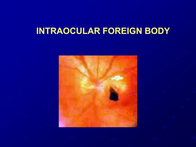 Intraocular foreign bodies - AJAY DUDANI | PPT | Death, Injury, or ...