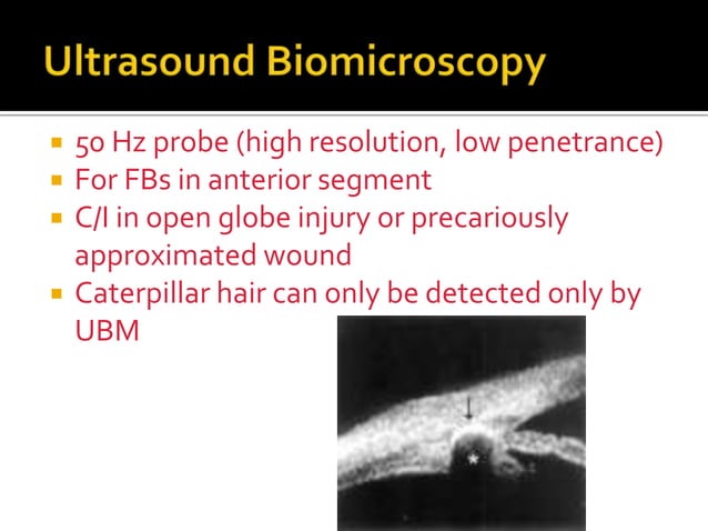 Intra ocular foreign body | PPTX | Eye and Vision Conditions | Diseases ...