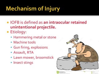 Intra ocular foreign body | PPTX