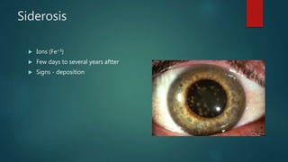 Intraocular foreign body | PPTX