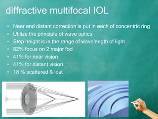 Intraocular lens | PDF