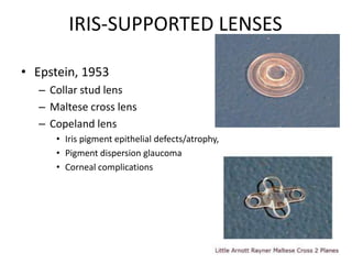 Intraocular lenses | PPTX
