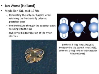 Intraocular lenses | PPTX