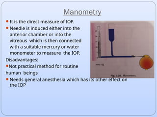 Intraocular pressure or fluid pressure of aq humor | PPTX