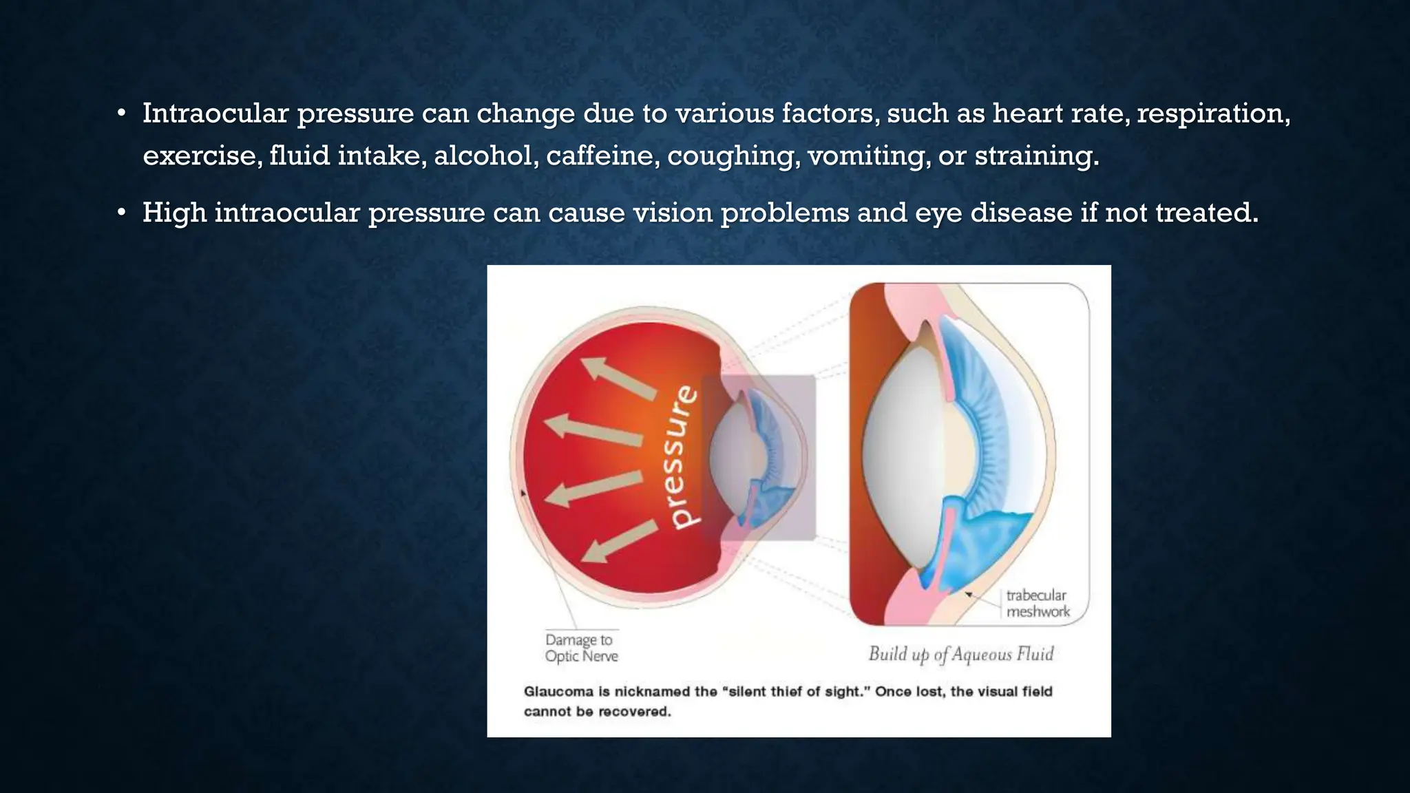 INTRAOCULAR PRESSURE .pdf