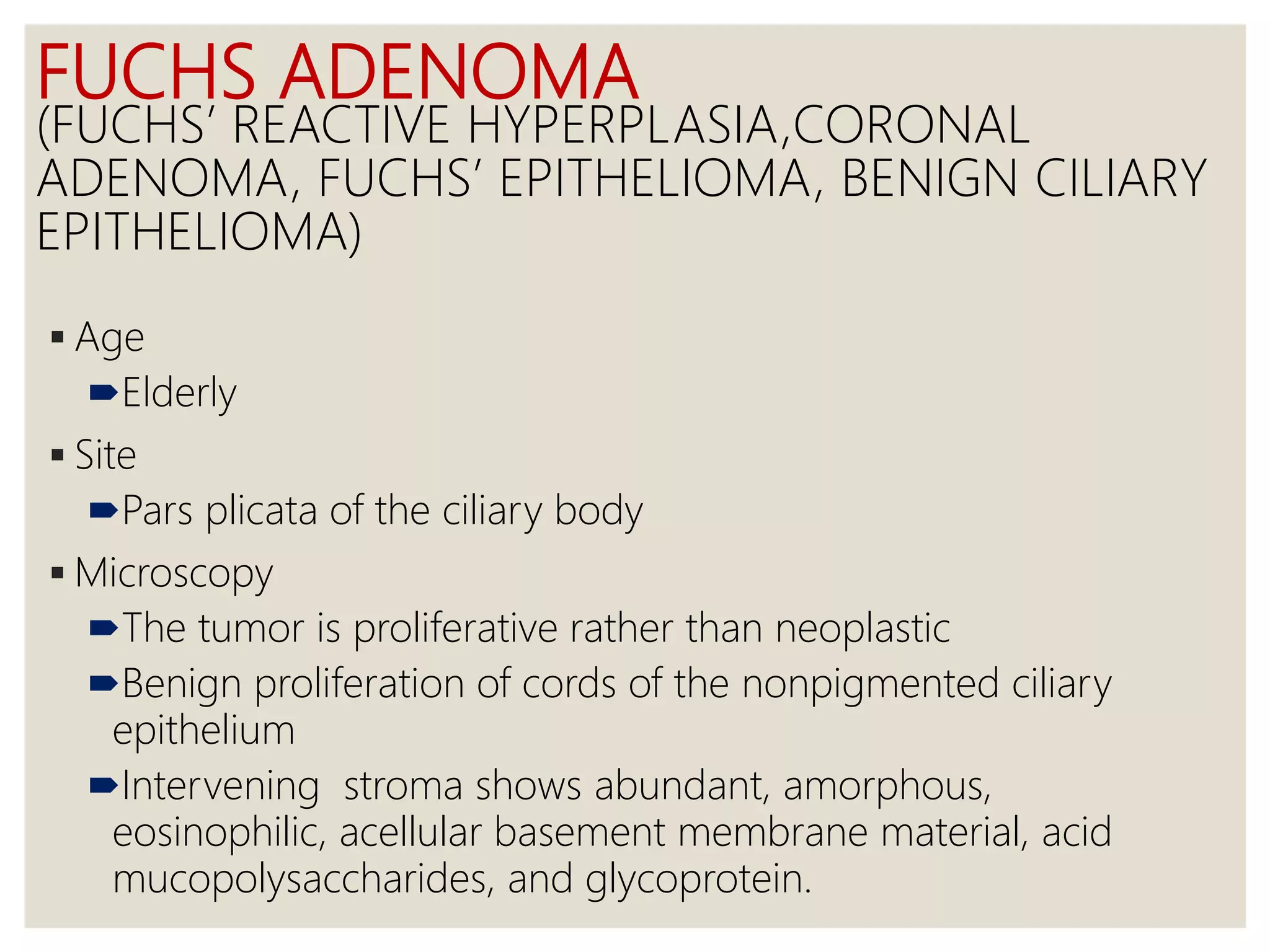 Intraocular tumors 18 | PPTX