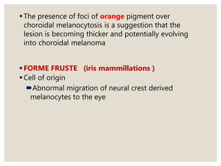 Intraocular tumors 18 | PPTX