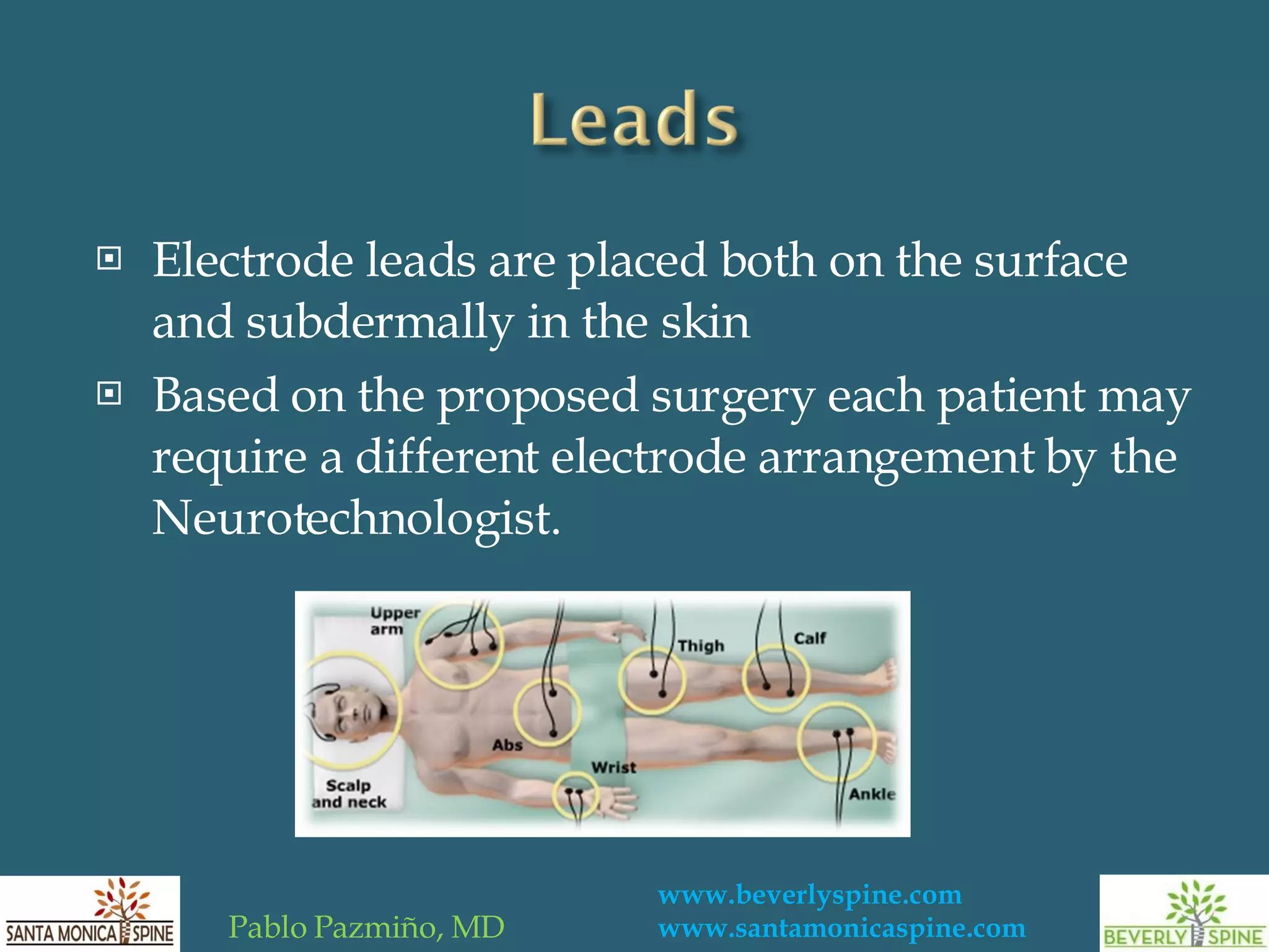 Intraoperative Monitoring | PPT