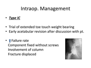 Intraoperative acetabular fracture and pelvic discontinuity in thr | PPTX