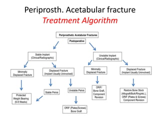 Intraoperative acetabular fracture and pelvic discontinuity in thr | PPTX
