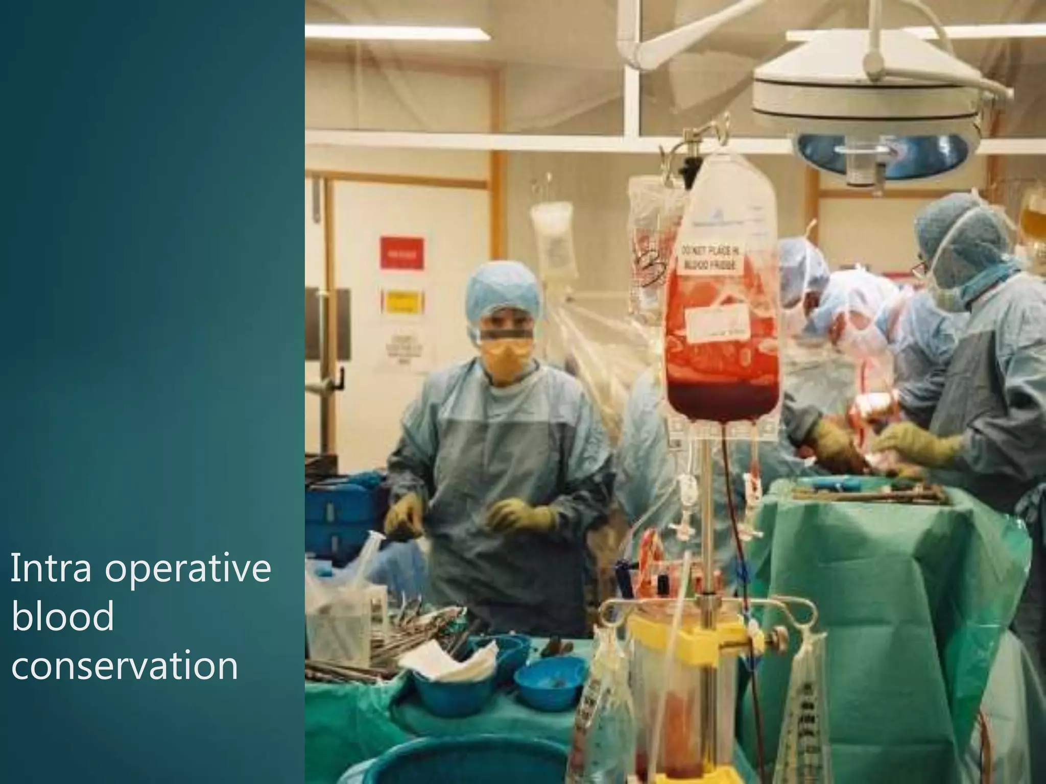 Intra operative blood_conservation | PPT