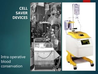 Intra operative blood_conservation | PPT
