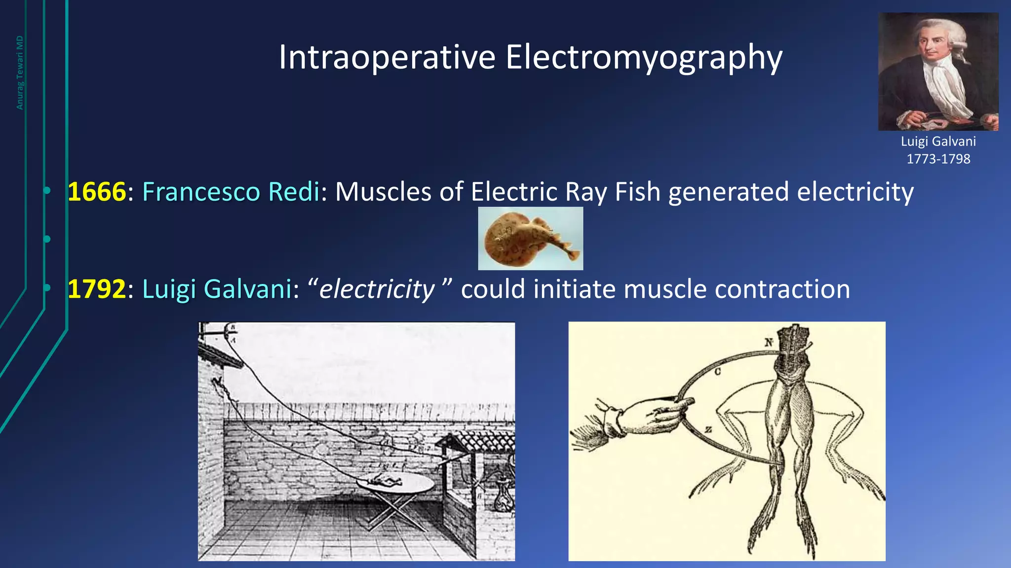 Intraoperative Electromyography (EMG) | PPTX