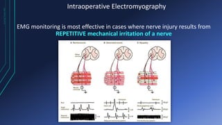 Intraoperative Electromyography (EMG) | PPTX