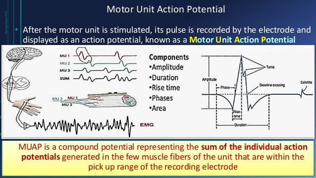 Intraoperative Electromyography (EMG)