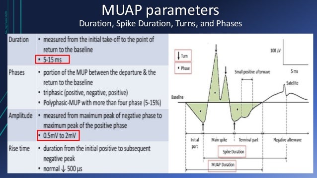Intraoperative Electromyography (EMG)