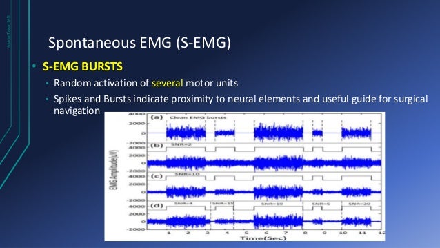 Intraoperative Electromyography (EMG)