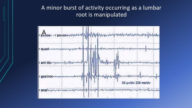 Intraoperative Electromyography (EMG)