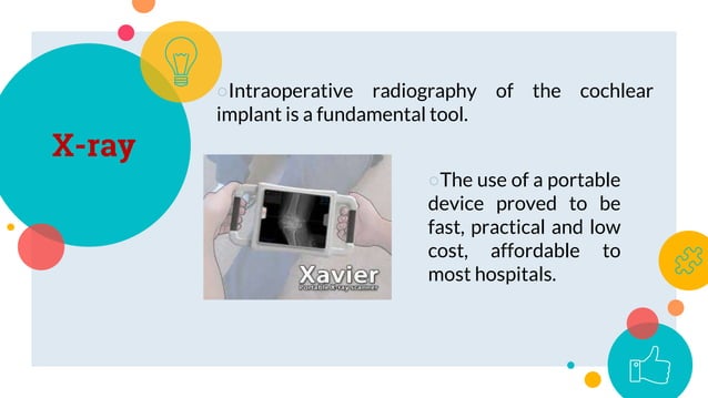 Intra-operative monitoring during CI surgery | PPTX | First Aid | Injuries