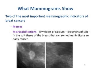Intraoperative radiotherapy carcinoma breast | PPTX