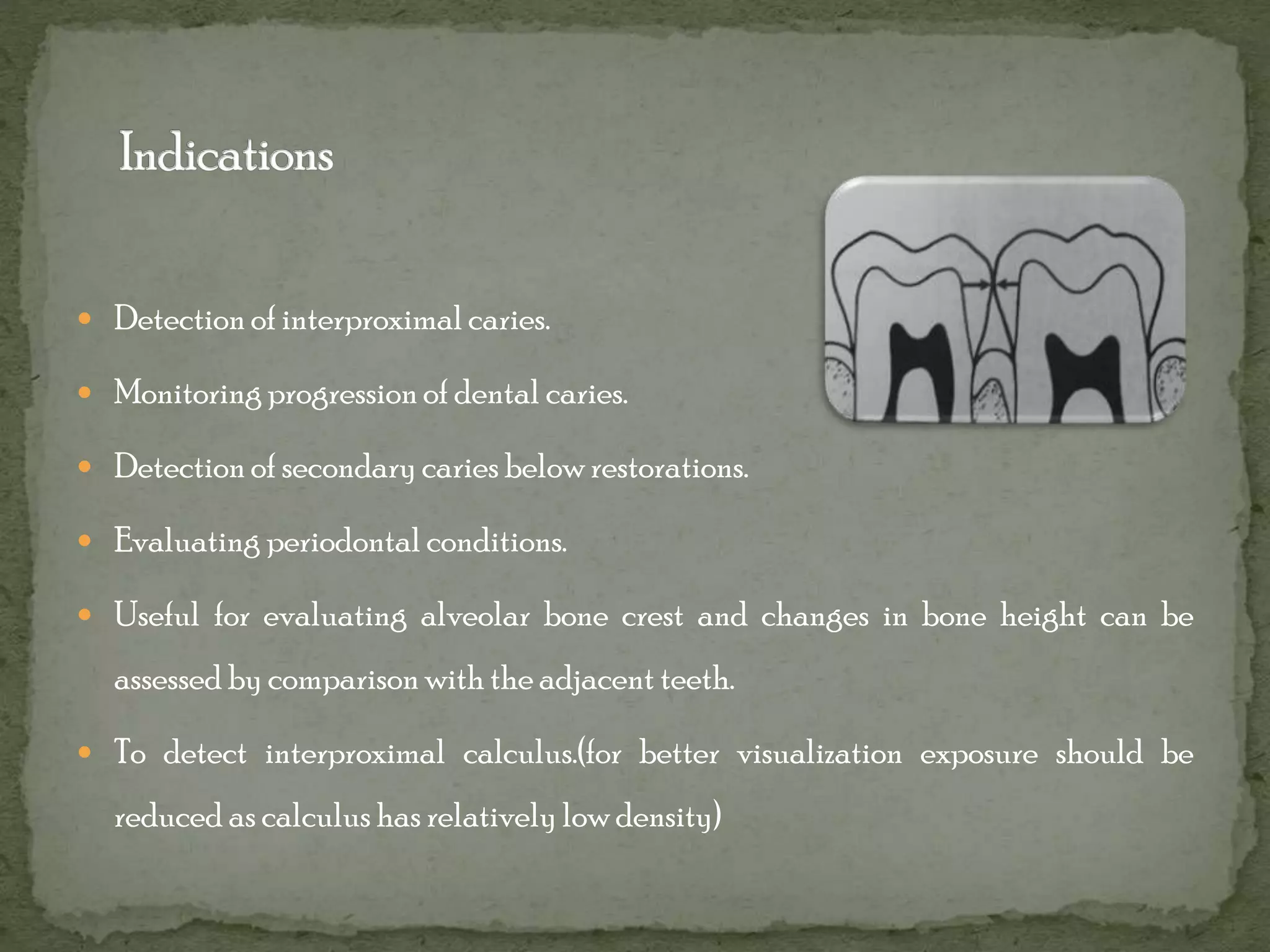 Intraoral radiographic technique ii | PPTX