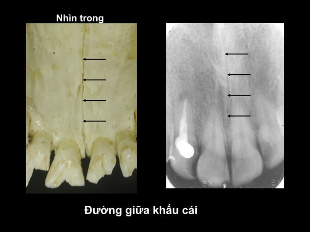 Intraoral anatomy | PPT