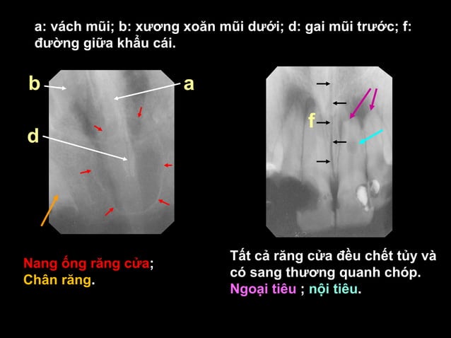 Intraoral anatomy | PPT